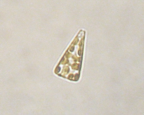 Article 190: Zoology - Part 1 - The Geometry of Diatoms & Radiolaria ...